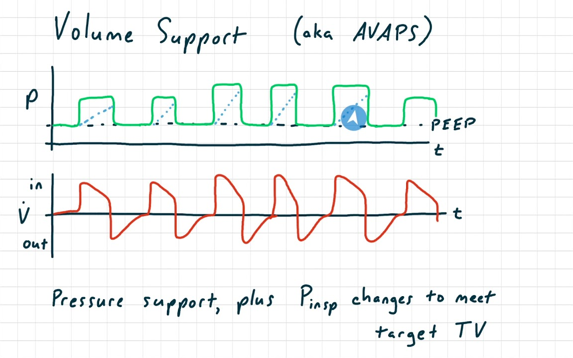Ventilator and Pulmonary Mechanics Chalk Talk Series – VQ School