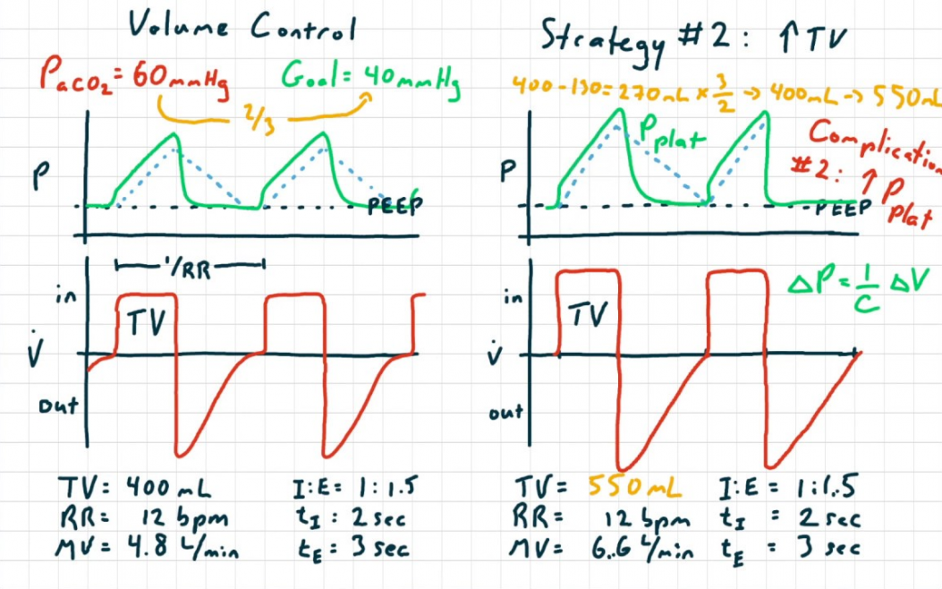Ventilator and Pulmonary Mechanics Chalk Talk Series – VQ School